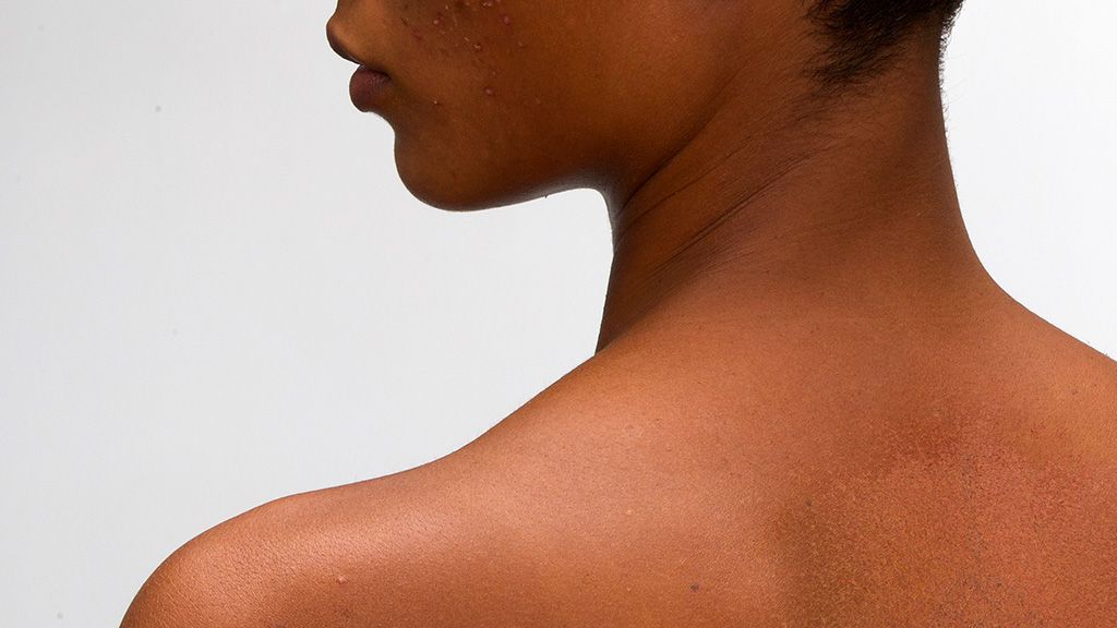 How to Improve Textured Skin & Bumpy Skin | CeraVe Australia