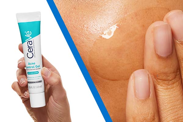 blackheads and whiteheads removal cream